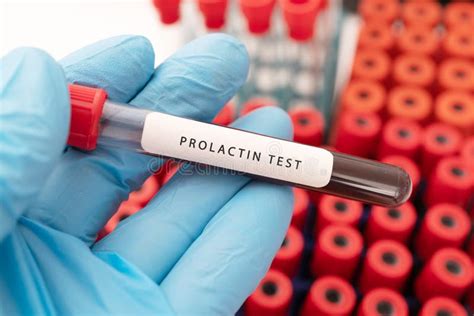 Hand Holding A Glass Of Test Tube With Patient S Blood For Testing