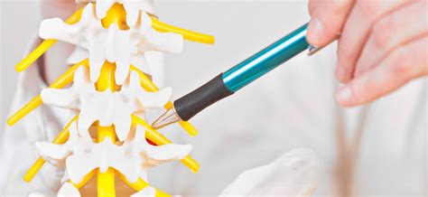 Протрузия дисков