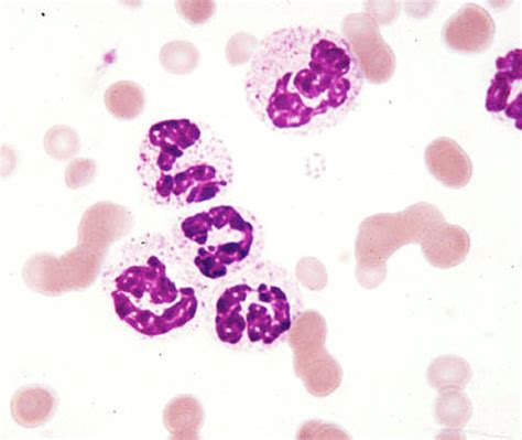 Lecture 28 Respiratory Infections Iv Flashcards Quizlet