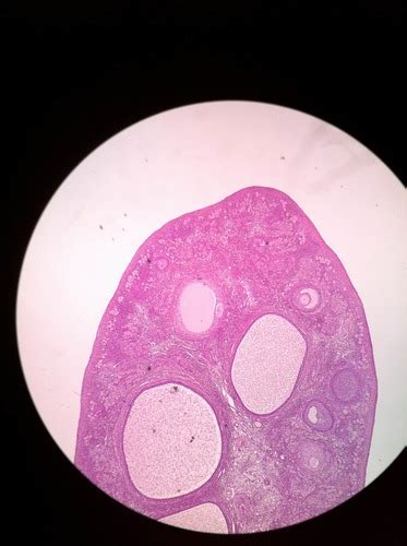 Mc Histo Lab Female Repro Lm S Flashcards Quizlet