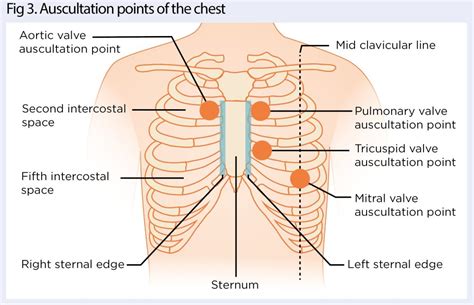 Cardiac Auscultation Mnemonic