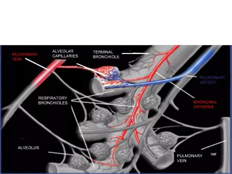 Bronchiectasis Ppt Lung And Respiratory Health Diseases And