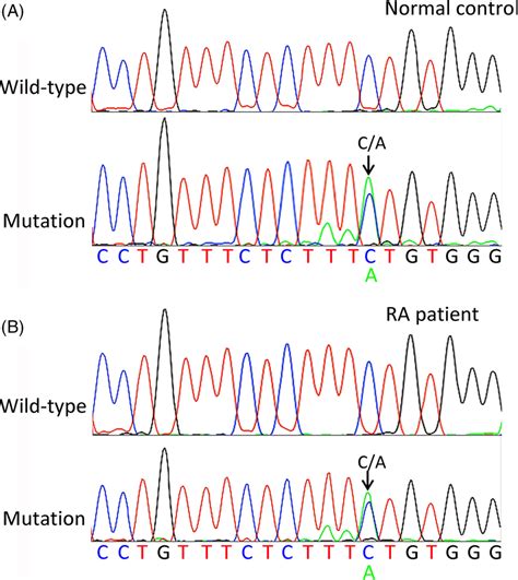 Direct Sequence Analysis Of Rs558555834 Showed Heterogeneous C To A Download Scientific Diagram