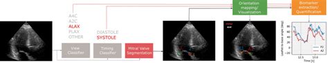 Mitral Valve Segmentation And Tracking From Transthoracic Echocardiography Using Deep Learning