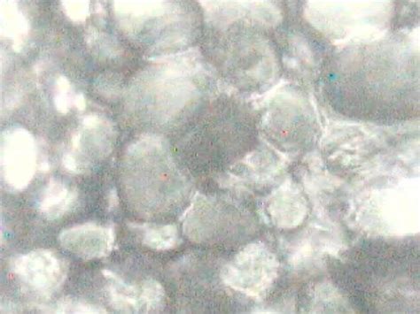 Botanica Inclusiones Celulares