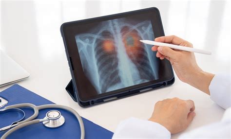 New Copd Criteria Spot High Risk Patients Missed By Spirometry Emj