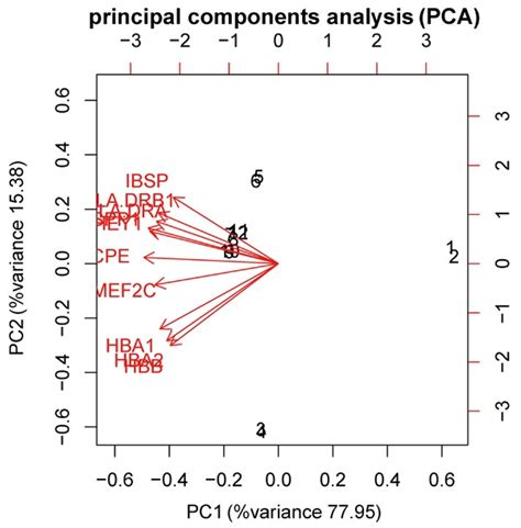 Gene Function Analysis In Osteosarcoma Based On Microarray Gene Expression Profiling Pmc