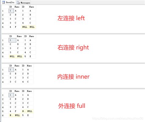SQL连接类型详解 CSDN博客