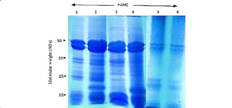 Sds Polyacrylamide Gel Electrophoresis Of Seed Protein Fractions Of