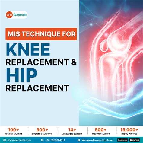 How Mis Technique For Knee Replacement And Hip Replacement Works Gomedii