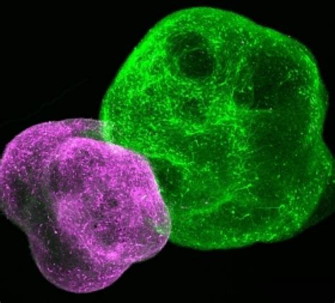 Here Come The Assembloids Wu Tsai Neurosciences Institute