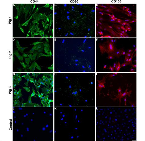 Immunophenotyping Reveals Expression Of Markers By All Three Lines Of