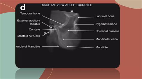 Cbct Anatomical Structures Pptx