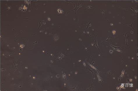心肌细胞 原代细胞 Str细胞 细胞培养基 赛百慷生物