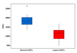 ADC Mapping With 12 B Values Can We Improve Image Quality In The Diffusion Sequence Of Prostate