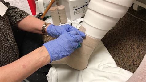 Lymphedema Wrapping Body Of Health