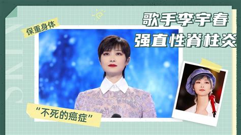 歌手李宇春患“强直性脊柱炎”，在节目表示：严重时需坐轮椅出行 Youtube
