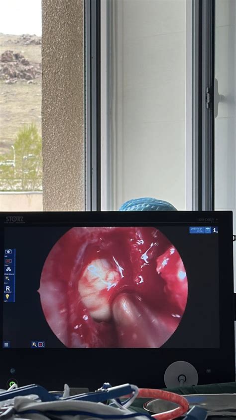 Орхон Орхон аймаг дахь Бүсийн Оношилгоо Эмчилгээний Төв