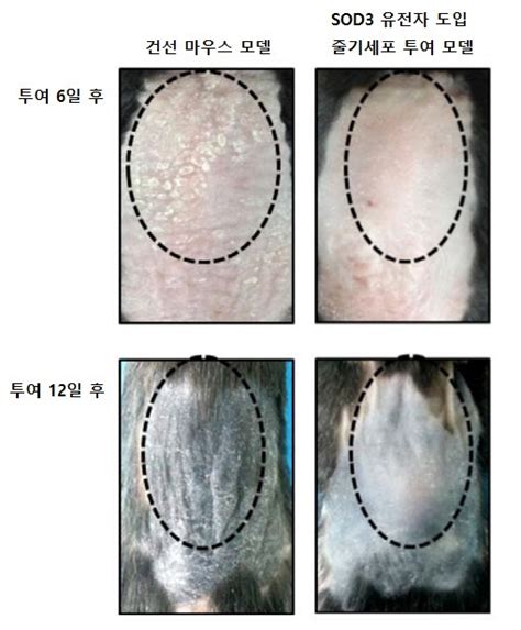 강스템바이오텍 유전자 도입 차세대 세포치료제 기술 美 특허 등록 디지틀조선일보디조닷컴