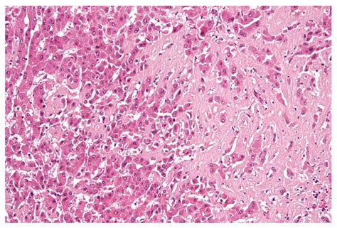 Watching Amyloid Form From Test Tubes To Tissues Faculdade De Ciências Da Universidade De Lisboa