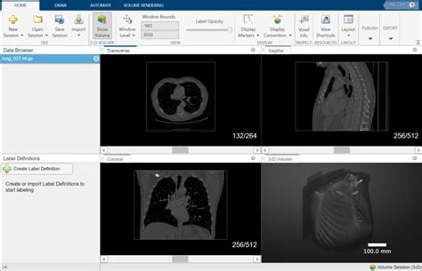 Visualize D Medical Image Data Using Medical Image Labeler Matlab