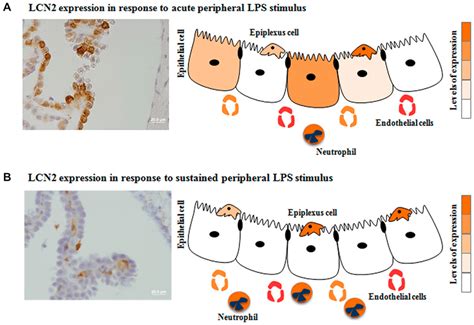 Choroid Plexus Cp Differential Response To Acute Vs Sustained