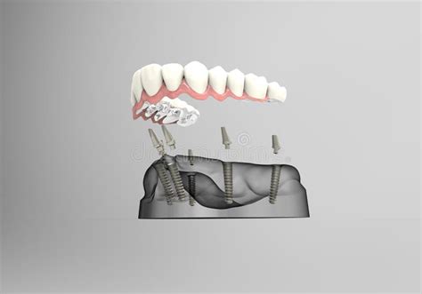 D Rendering Teeth Stock Illustration Illustration Of Dental