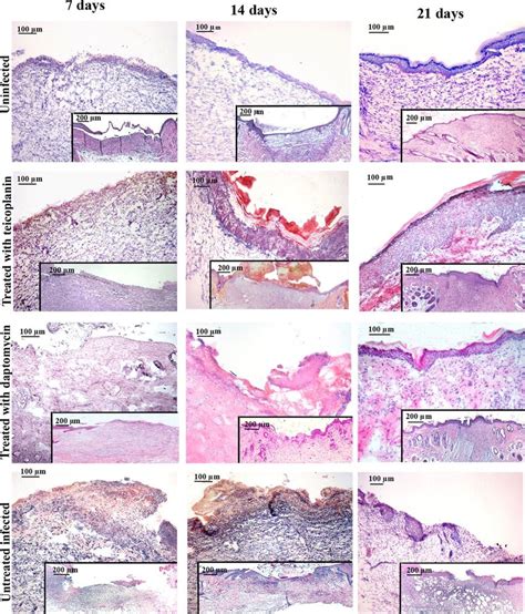 Representative Images Of Hematoxylin And Eosin Stained Histological