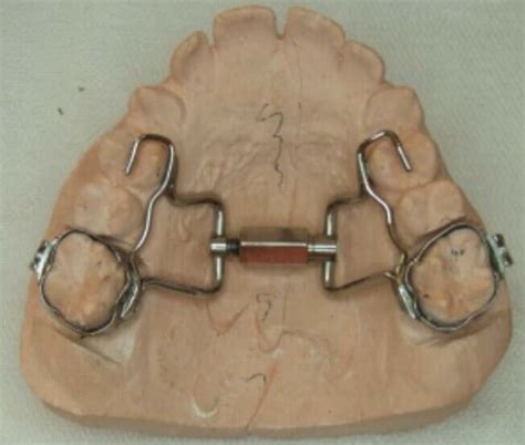 Hyrax — Newport Medical Dental