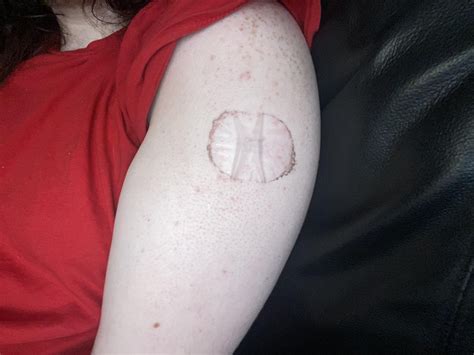 Are Estrogen Patches Supposed To Look Like This R Trans