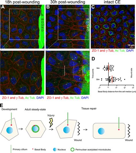 Figure 4 From Primary Cilia Dynamics Instruct Tissue Patterning And