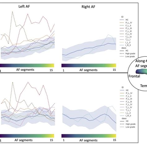Along Tract Diffusion Tensor Imaging Dti Measures A Mean Download Scientific Diagram