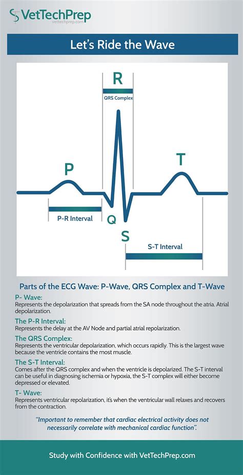 Infographic Parts Of The Ecg Wave Artofit
