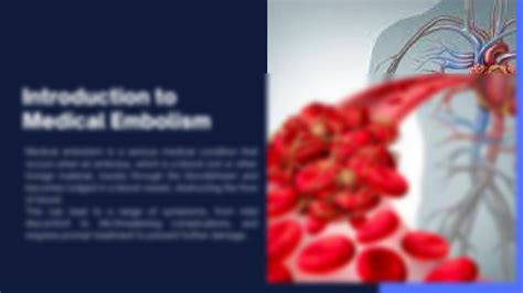 Solution Medical Embolism Causes Treatment And Prevention Presentation
