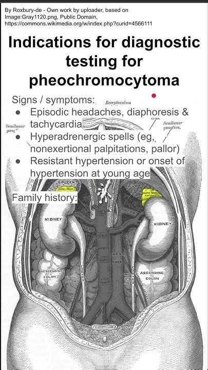 Indications For Diagnostic Testing For Pheochromocytoma Youtube