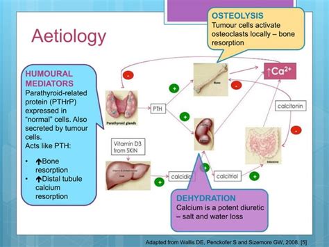 Hypercalcaemia In Malignancy Pptx