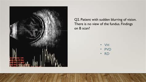 B Scan Procedure Basics In Ophthalmologypptx