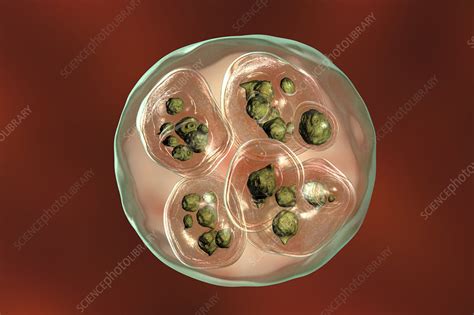 Echinococcus Multilocularis Hydatid Cyst Illustration Stock Image