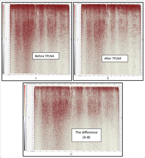8 The Result Of Applying Tau P Linear Noise Attenuation Filter Tplna