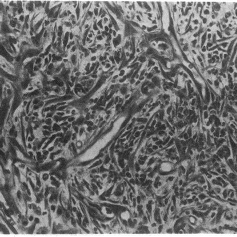 Morphological Features Of Sponges After Sustained Release Of Egf A