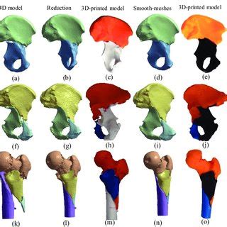 Three Clinical Cases Of Simulated Mesh Overlapping Download Scientific Diagram