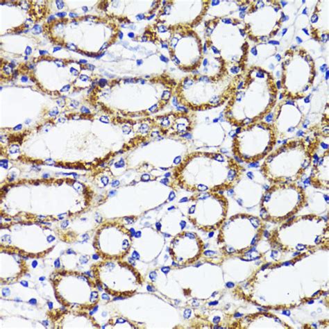 Socs3 Polyclonal Antibody Epigentek