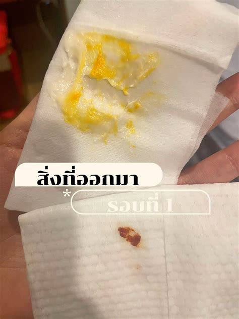 รีวิวเต้านมอักเสบ เต้าแข็ง เป็นไข้😭 แกลเลอรีที่โพสต์โดย Kierachen💚