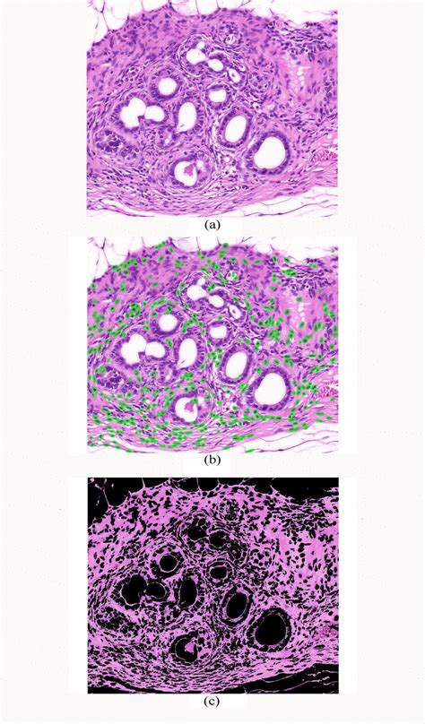 nuclei and stroma segmentation examples a original image b