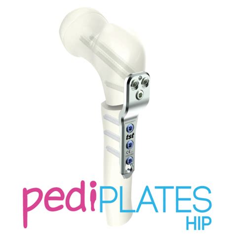 Deformity Correction Peditst