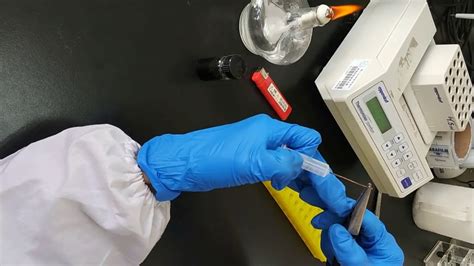 A Hydrogel Biosensor For Detection Of Aβo Video Abstract Id 152163