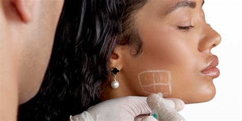 Masseter Dr Band Clinic