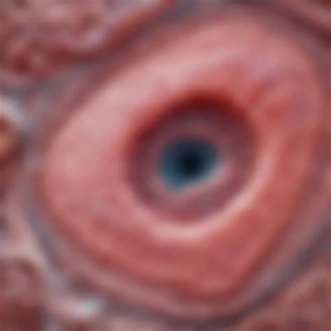 Understanding Uip Pattern In Interstitial Lung Disease