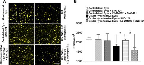 A Fluorescence Micrographs Of Flat Mounted Retinas Depicting