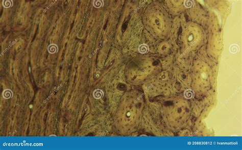 Bone Cells Under A Microscope